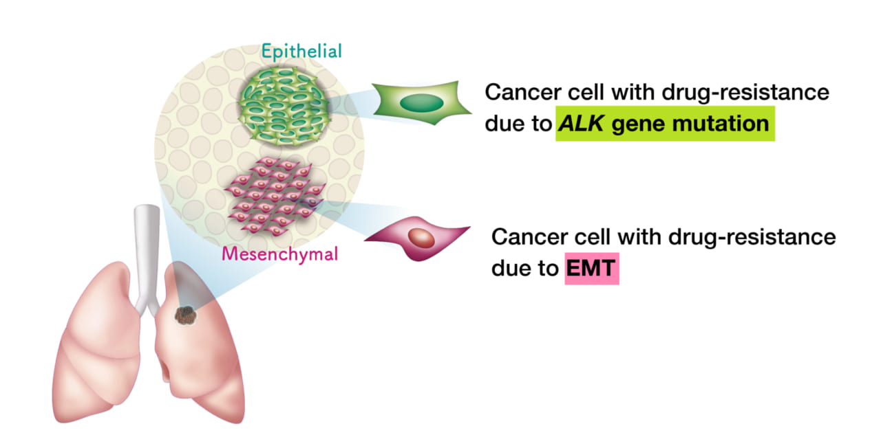 Acquisition of molecular-targeted drug resistance by lung cancer cells ...