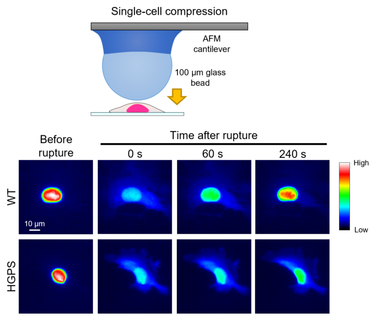 How Cells Repair DNA’s Protective Barrier: A pathway to address a rare ...