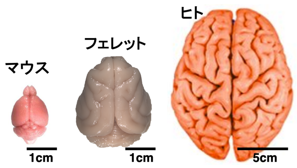 脳のゴミを除去する新たな仕組みを発見！ 金沢大学 ナノ生命科学研究所