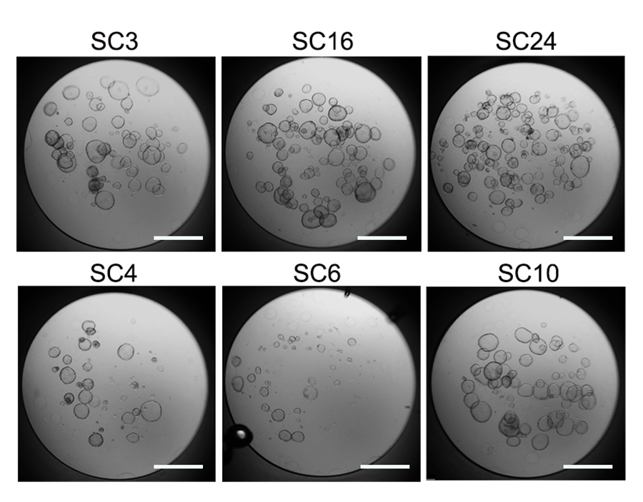 Cancer biology: Some cancer cells can lose their capability to migrate ...